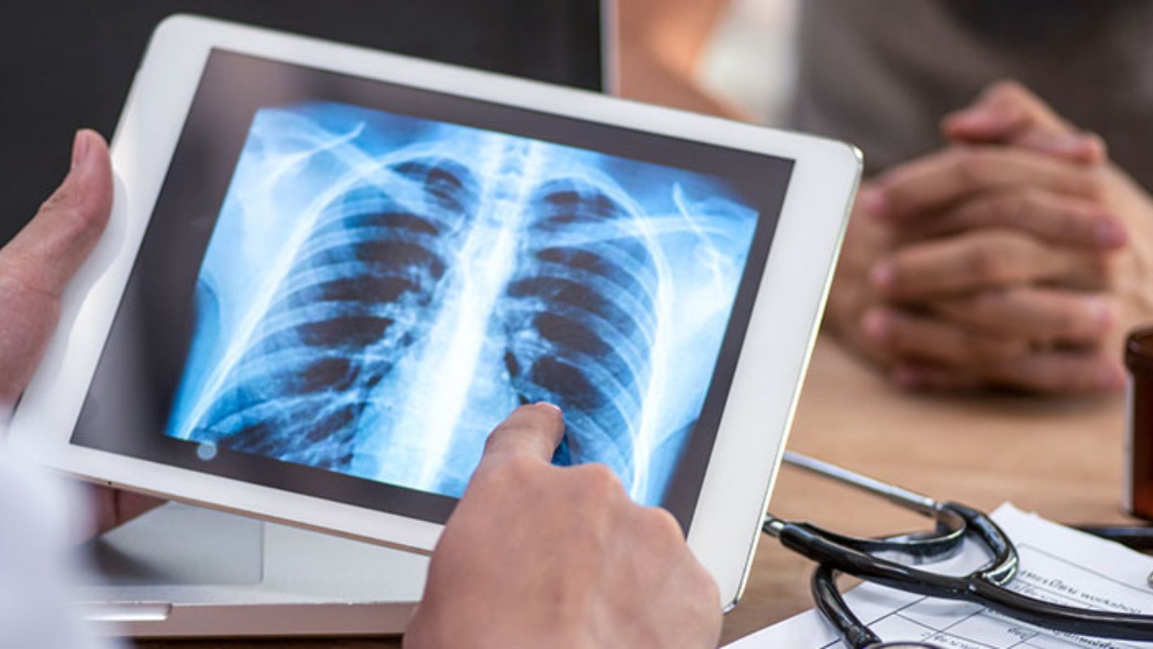 Understanding Lung Nodules: Akciğerde 7 mm Nodül Var Korkuyorum ...