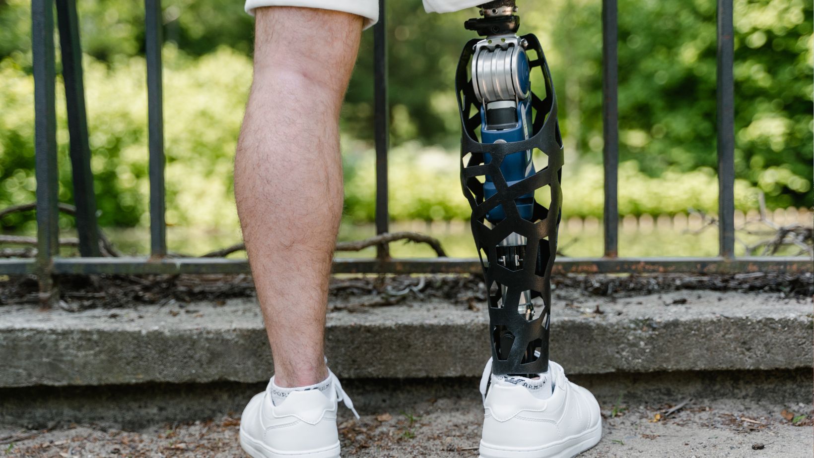 The Role of 3D Printing in Custom Prosthetics and Bionic Limbs - Travel ...